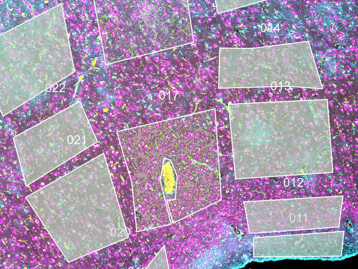 Platforms | APPLIED SPATIAL OMICS CENTRE | Cumming School of Medicine | University of Calgary